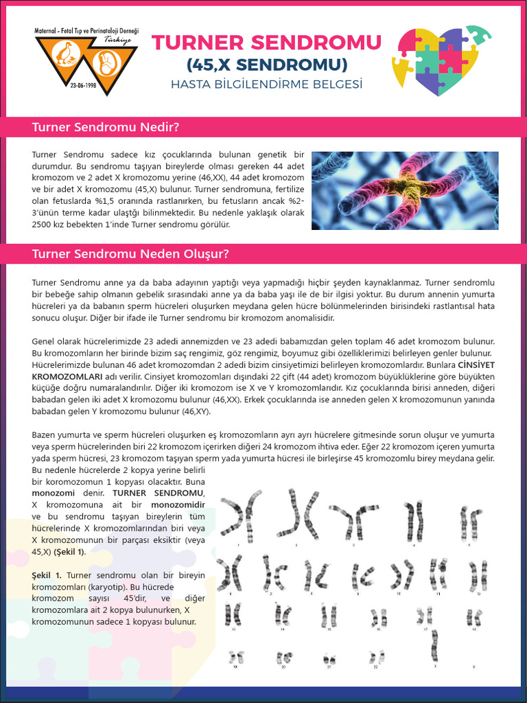 Turner Sendromu | PDF