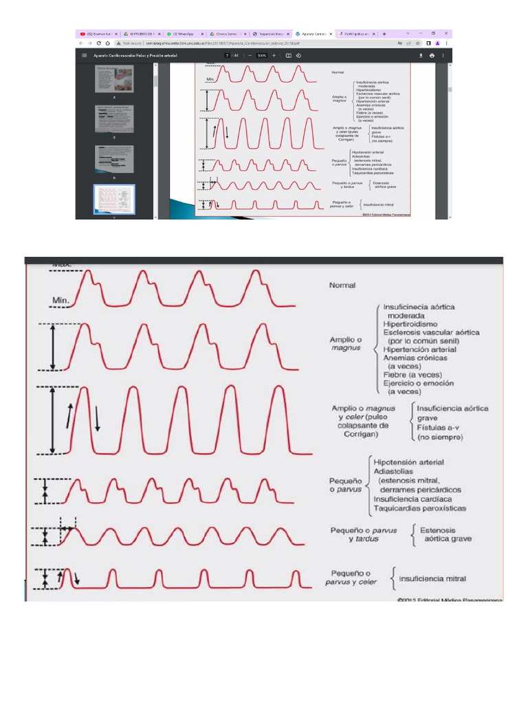 tipos de pulso arterial | PDF