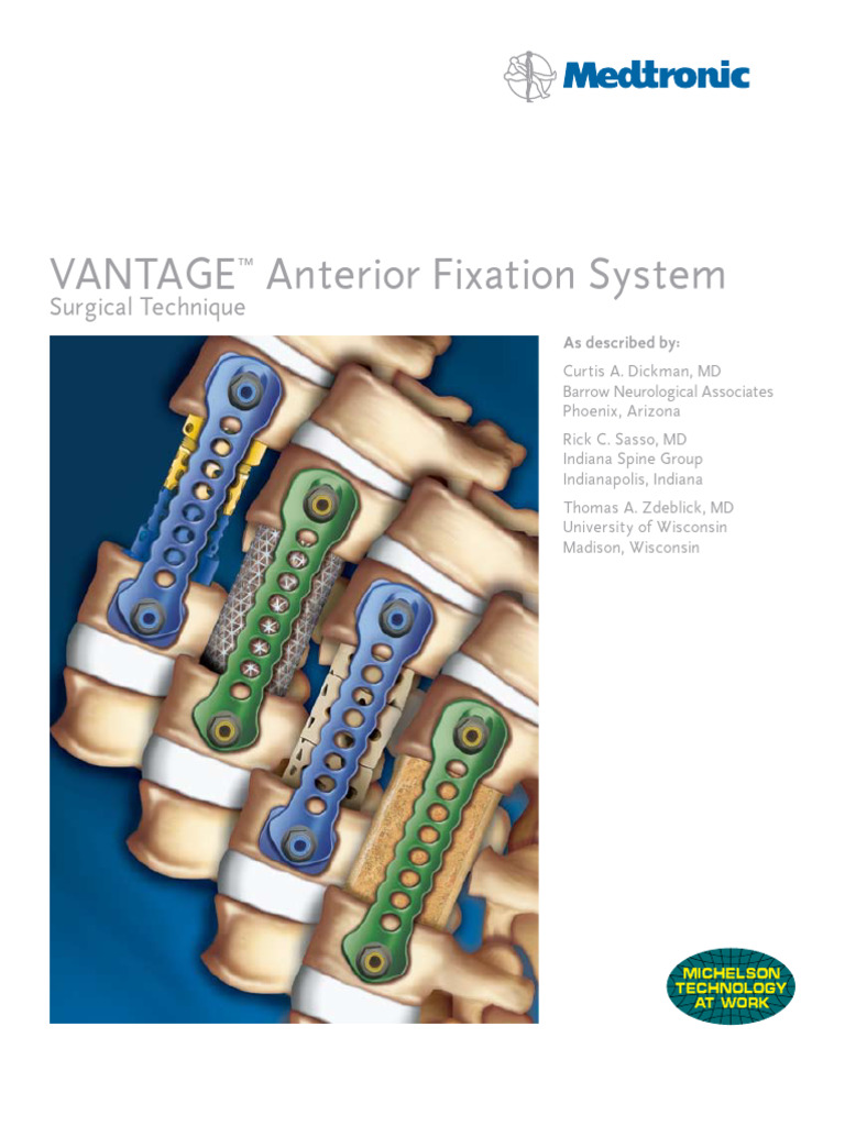 Vantage Tq | PDF | Vertebral Column | Vertebra