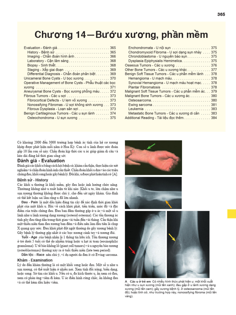 Syu Tym Bai Viyt. TYng Quan BYYu xYYng - Phyn Mym | PDF