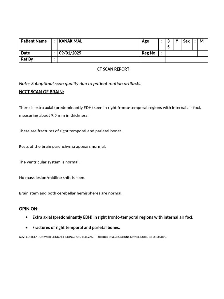 Brain CT Scan Report: EDH & Fractures | PDF
