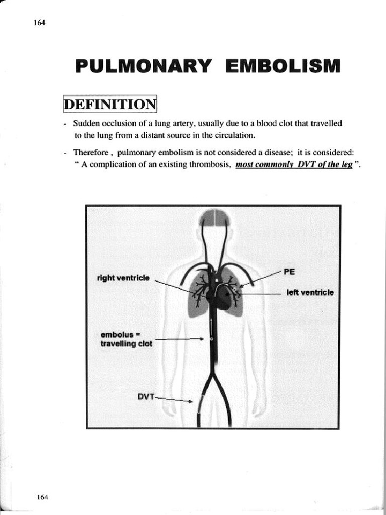 DVT | PDF
