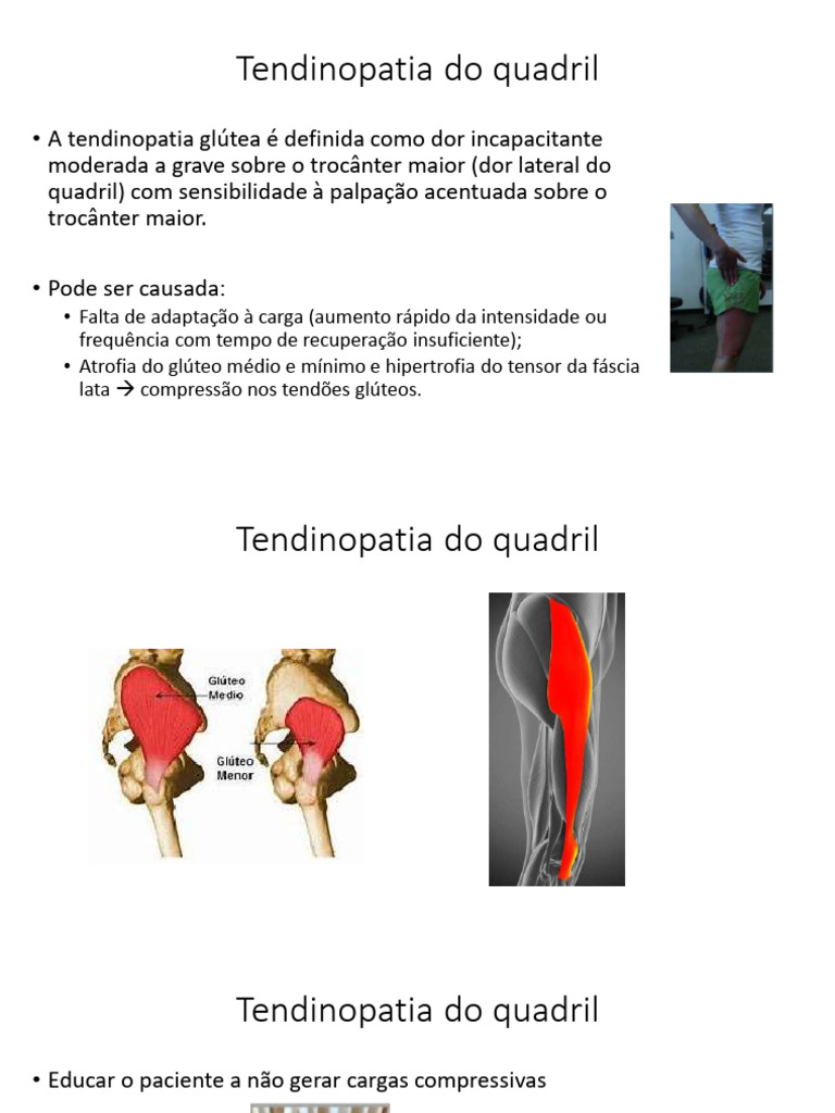 TENDINOPATIA DO QUADRIL | PDF