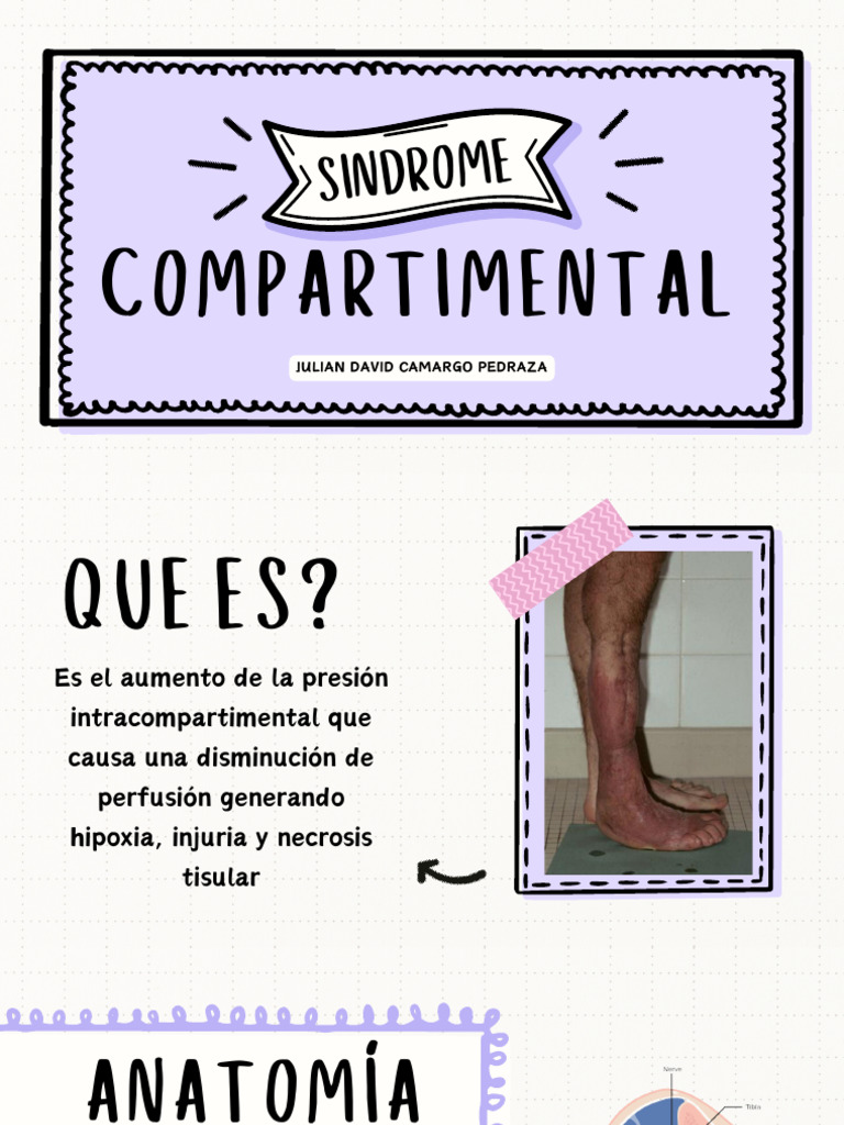 Síndrome Compartimental: Diagnóstico y Tratamiento | PDF | Enfermedades ...