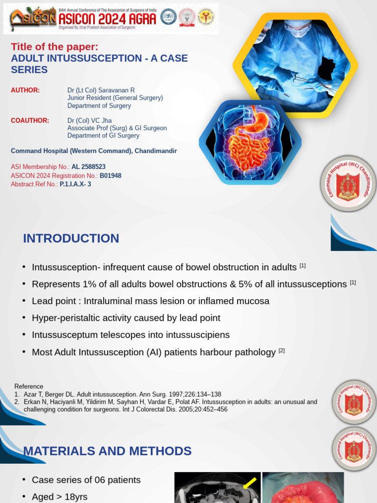Adult Intussusception Case Series Analysis | PDF | Medicine | Digestive ...