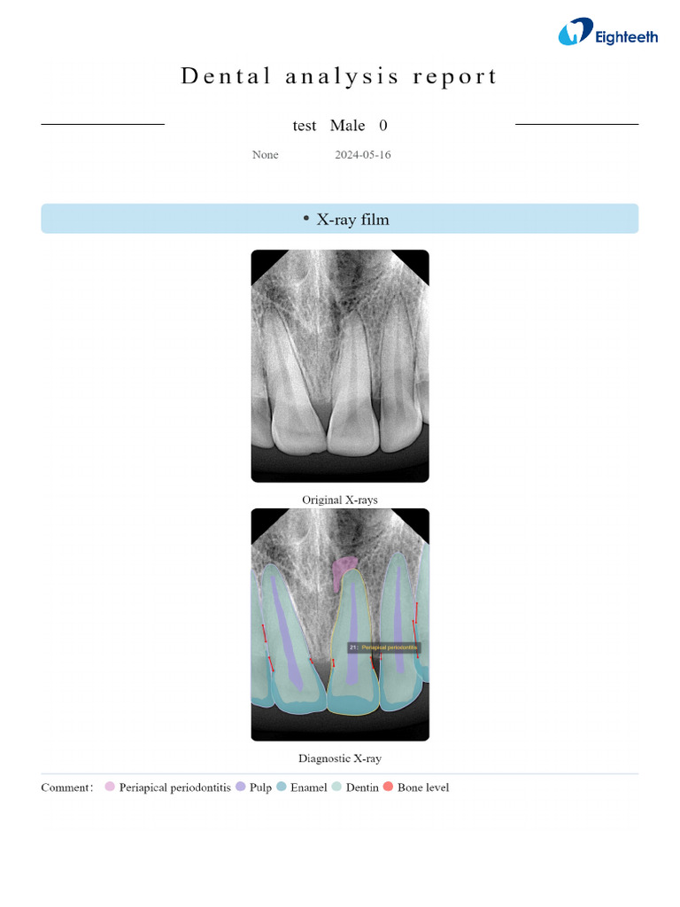 Dental Analysis Report | PDF