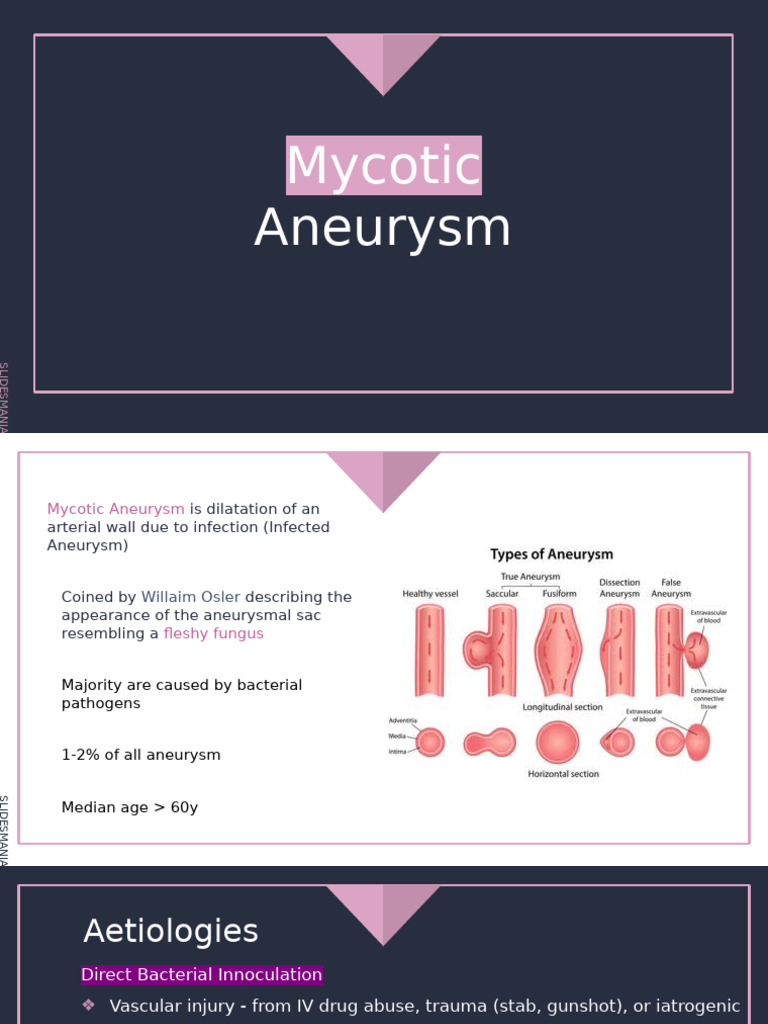 CME - Mycotic Aneurysm 7.1.24 | PDF | Interventional Radiology ...