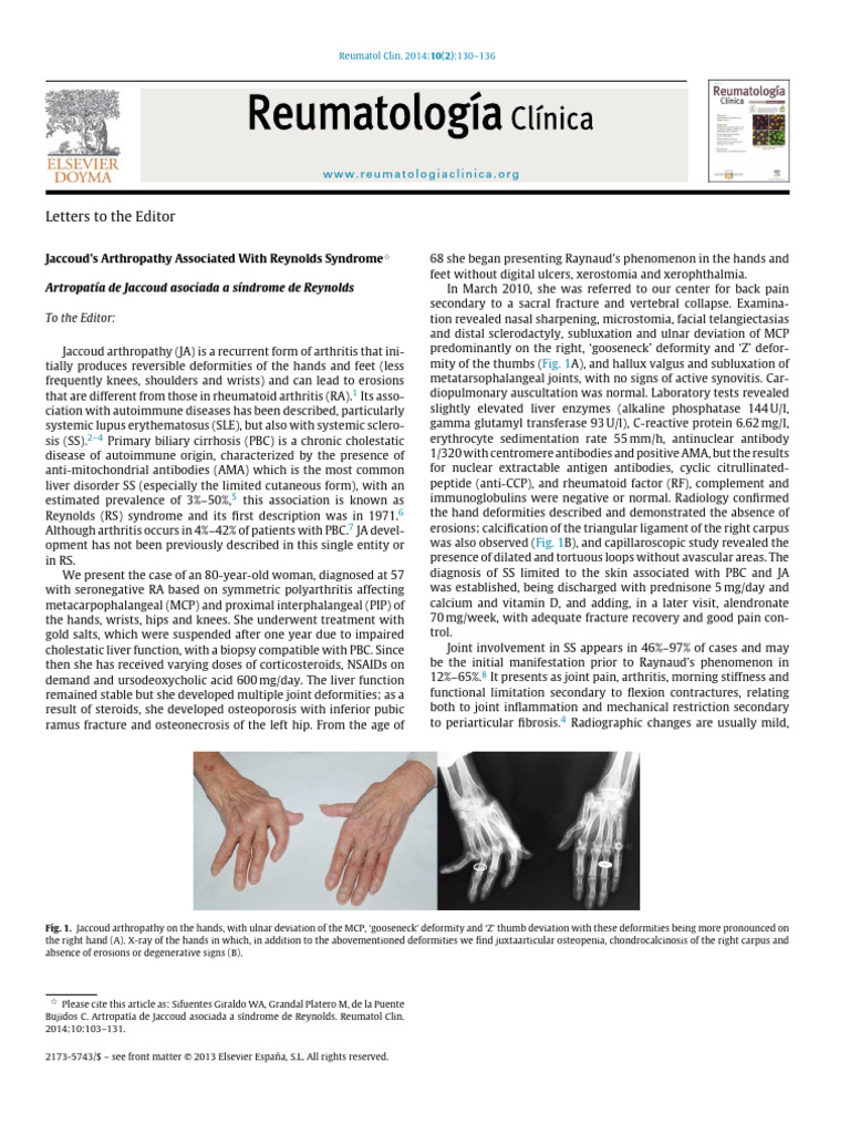 Jaccoud's Arthropathy in Reynolds Syndrome | PDF | Rheumatology ...