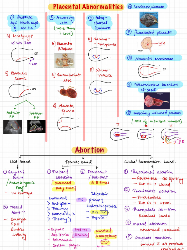 OBG Mindmaps ? | PDF