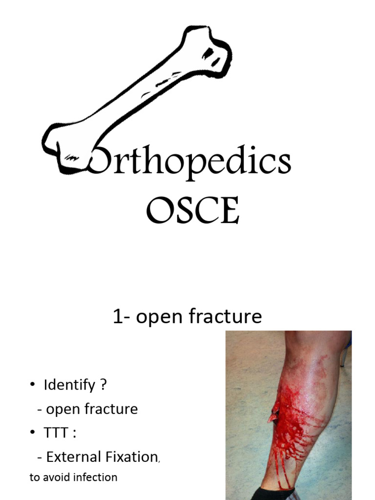 Gouty Tophi and Pronator Syndrome Insights | PDF | Gout | Hip