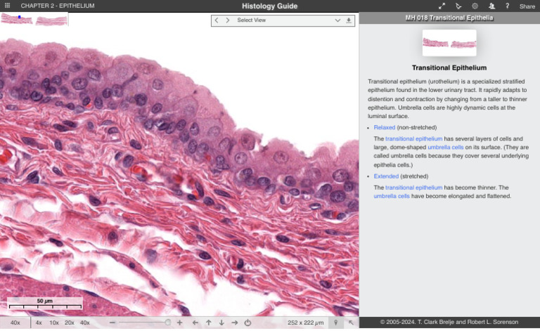 Transitional Epithelium Epithelium | PDF