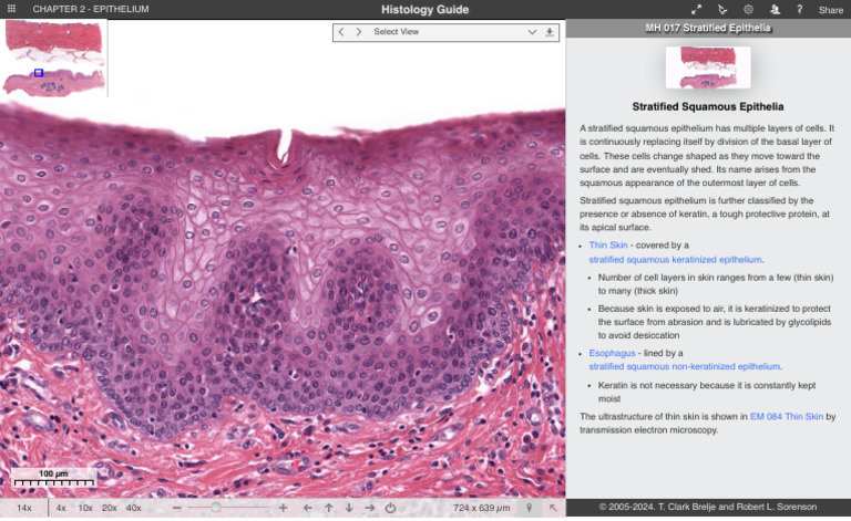 Stratified Squamous Epithelium Epithelium 2 | PDF | Epithelium | Microscopy