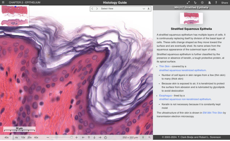 Stratified Squamous Epithelium Epithelium | PDF | Epithelium | Tissue ...