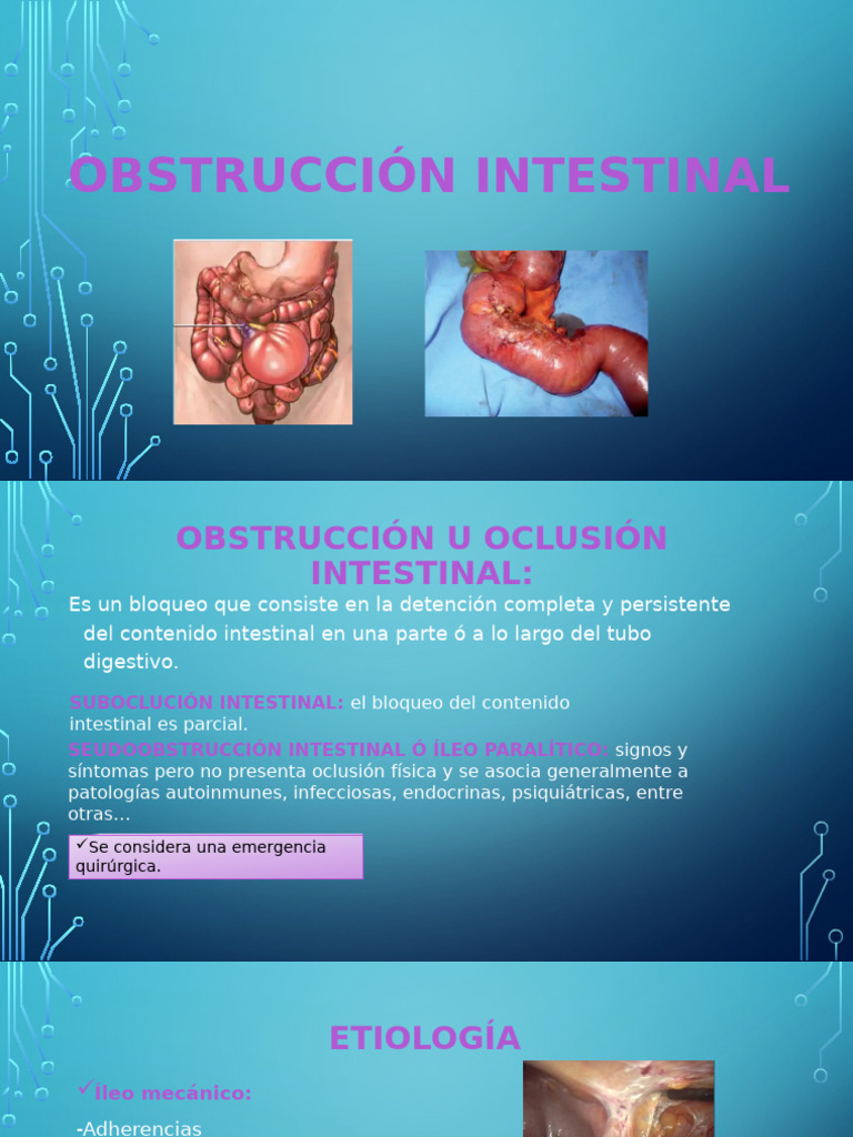 Obstrucción Intestinal: Causas y Tratamiento | PDF | Especialidades ...