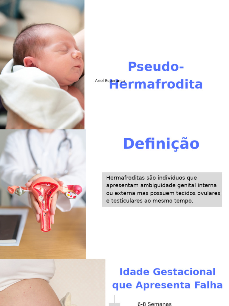 Pseudo Hermafrodita | PDF | Intersexo | Sexo