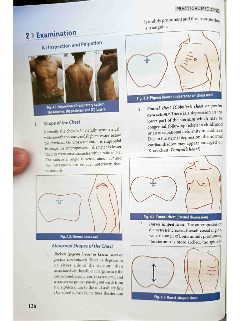 Respi Examination | PDF