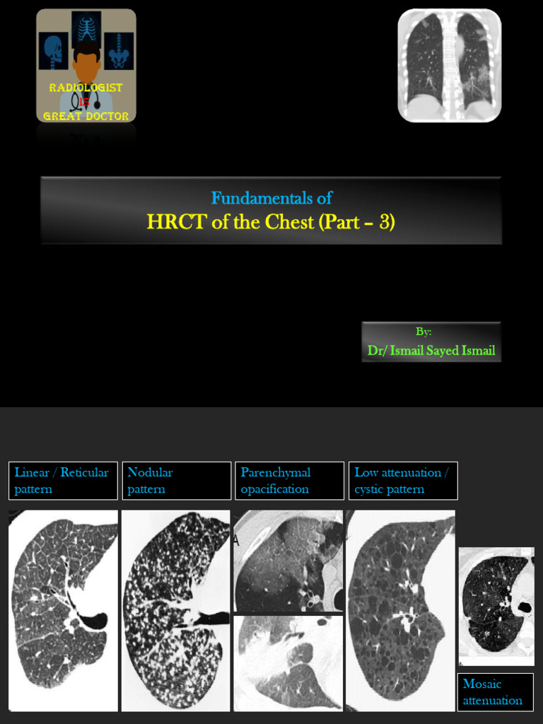 HRCT Chest Part - 3 | PDF | Lung | Medical Specialties