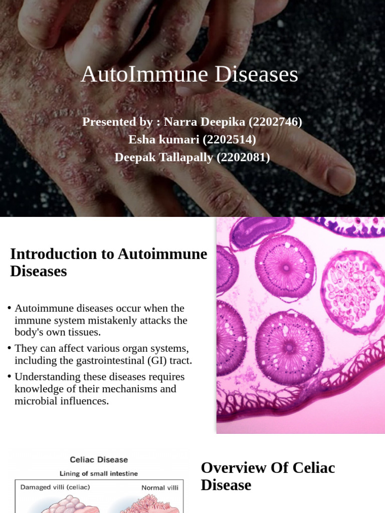 AutoImmune Diseases Immuno | PDF | Coeliac Disease | Crohn's Disease