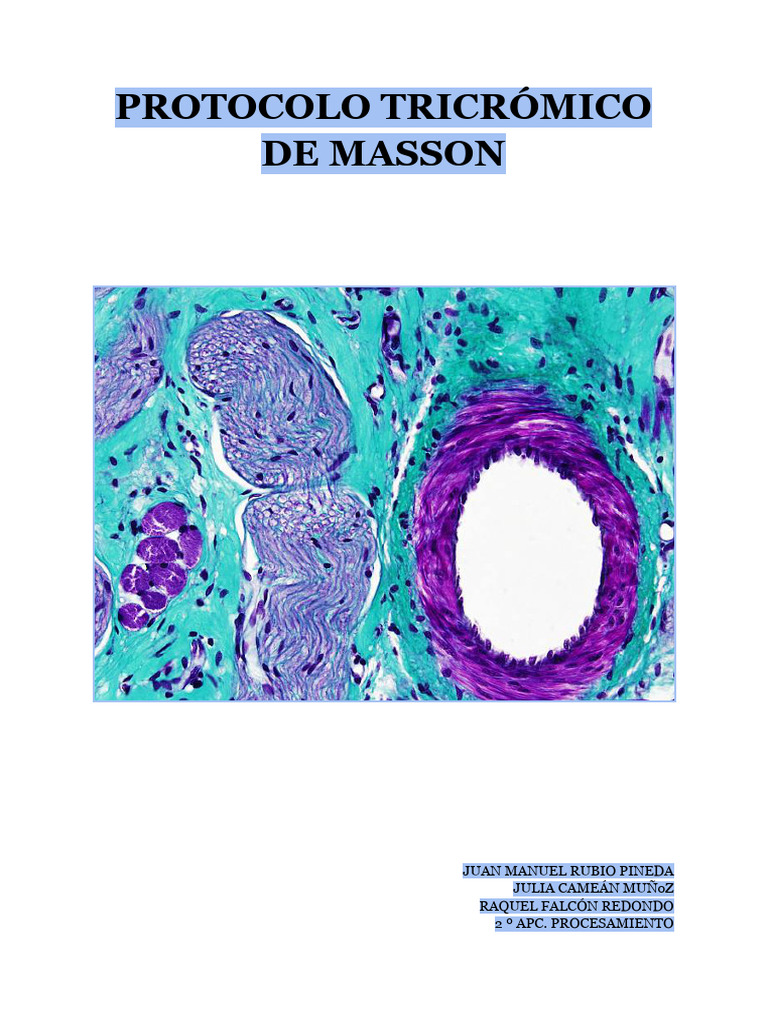 Protocolo Tricrómico de Masson | PDF | Tinción | Microscopía