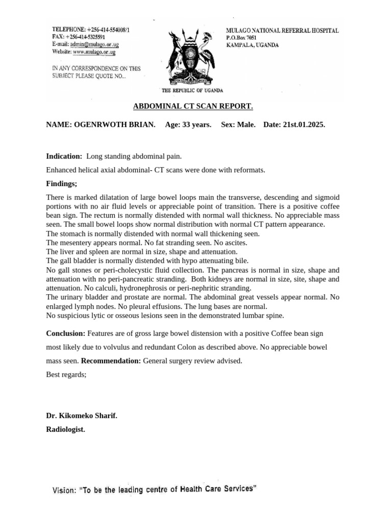 Ogenrwoth Brian Sigmoid Voluvulus | PDF