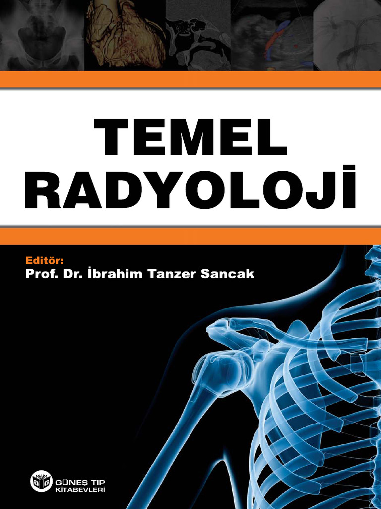 Temel Radyoloji | PDF