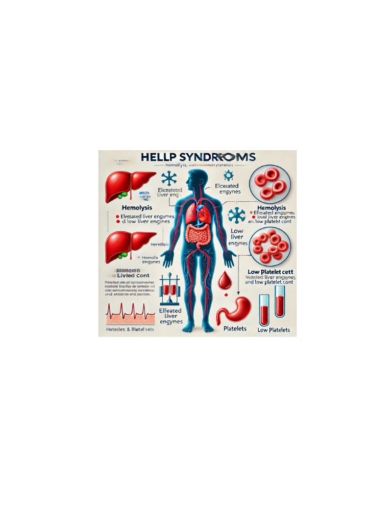 Understanding HELLP Syndrome in Pregnancy | PDF | Pregnancy | Human ...