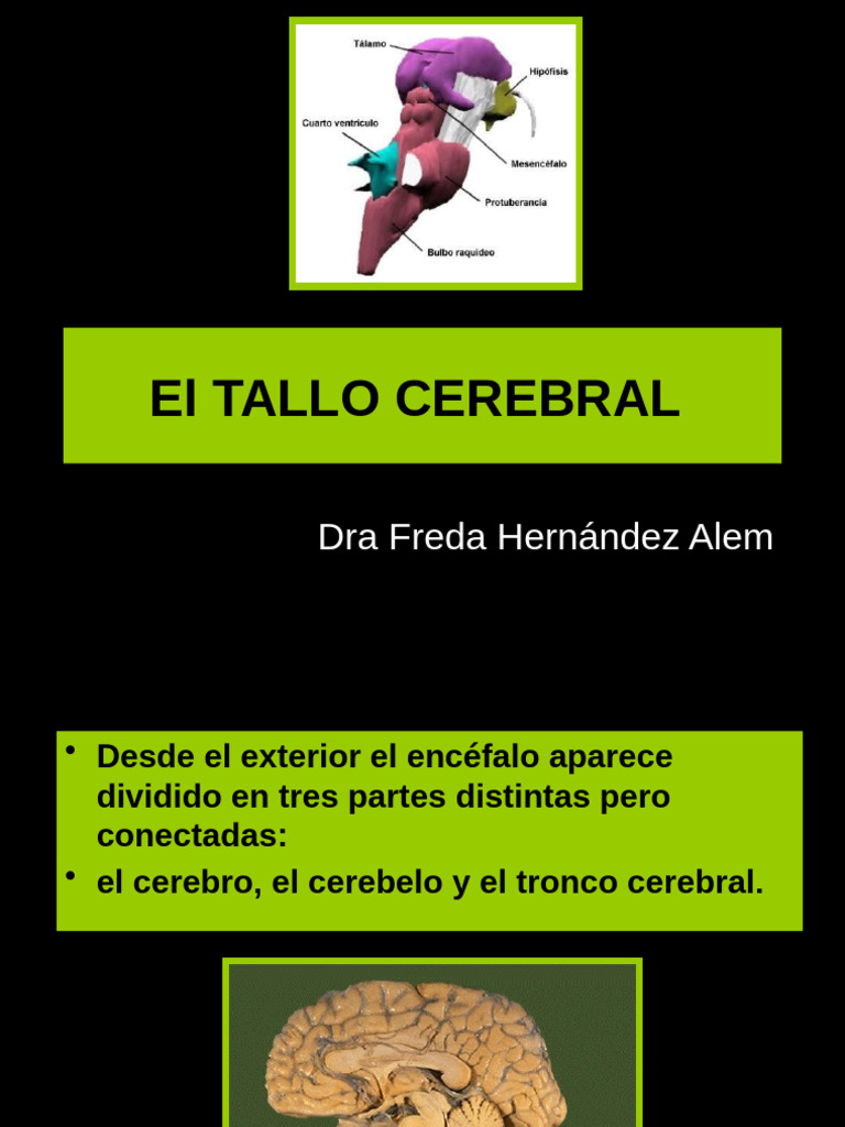Estructura y Funciones del Tallo Cerebral | PDF | Neuroanatomía ...