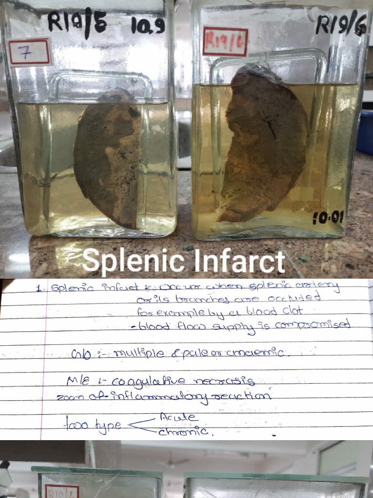 Pathology Specimens | PDF