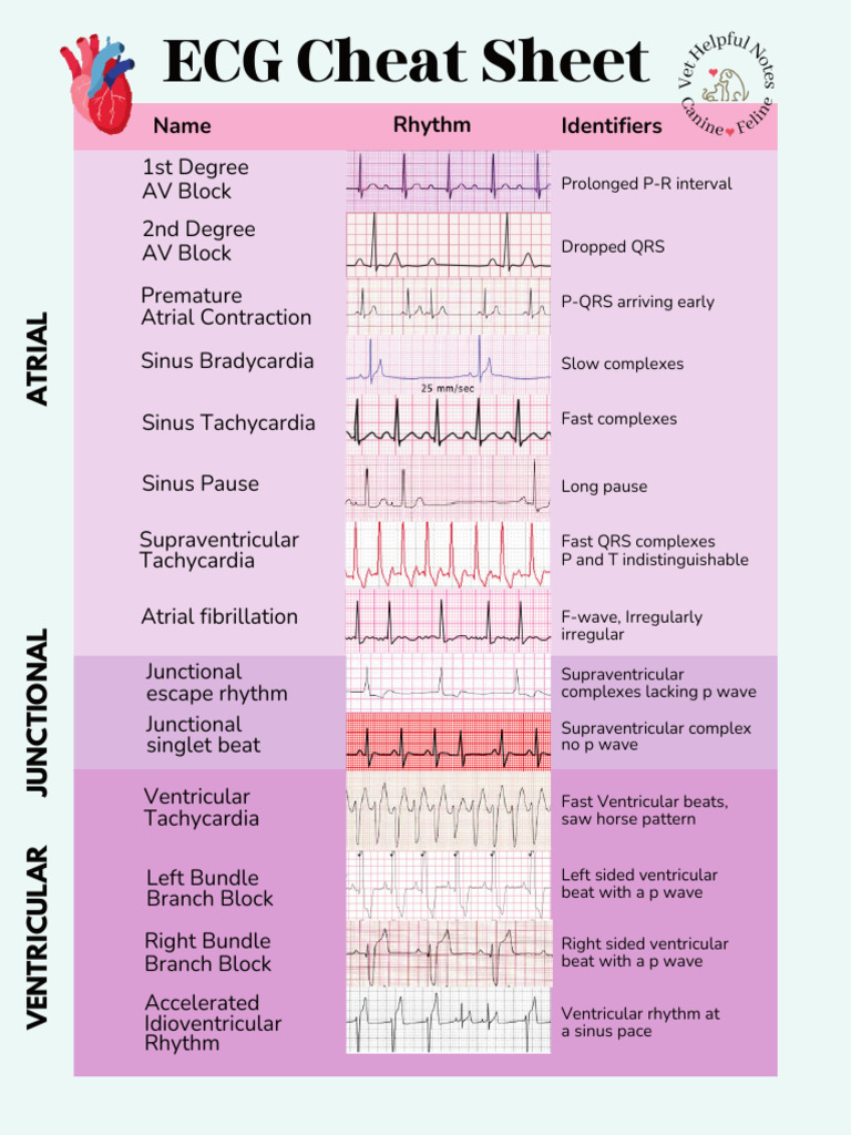 Arrhythmias Printable Sheet | PDF