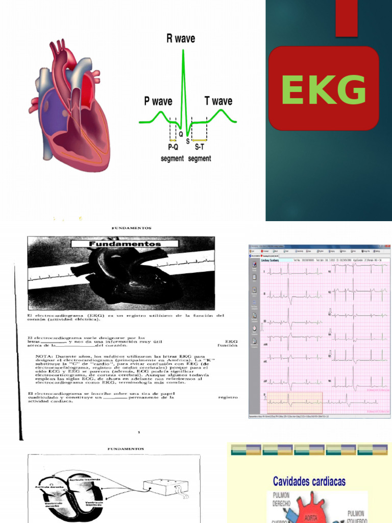 Curso de Ekg | PDF