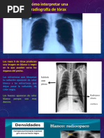 Cómo leer una radiografía de tórax | PDF | Tórax | Tórax (anatomía humana)