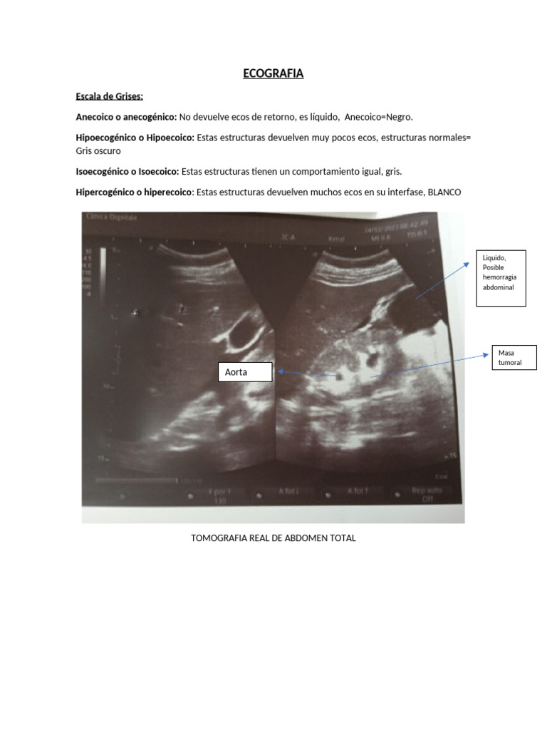 Guía de Ecografía y Tomografía Abdominal | PDF