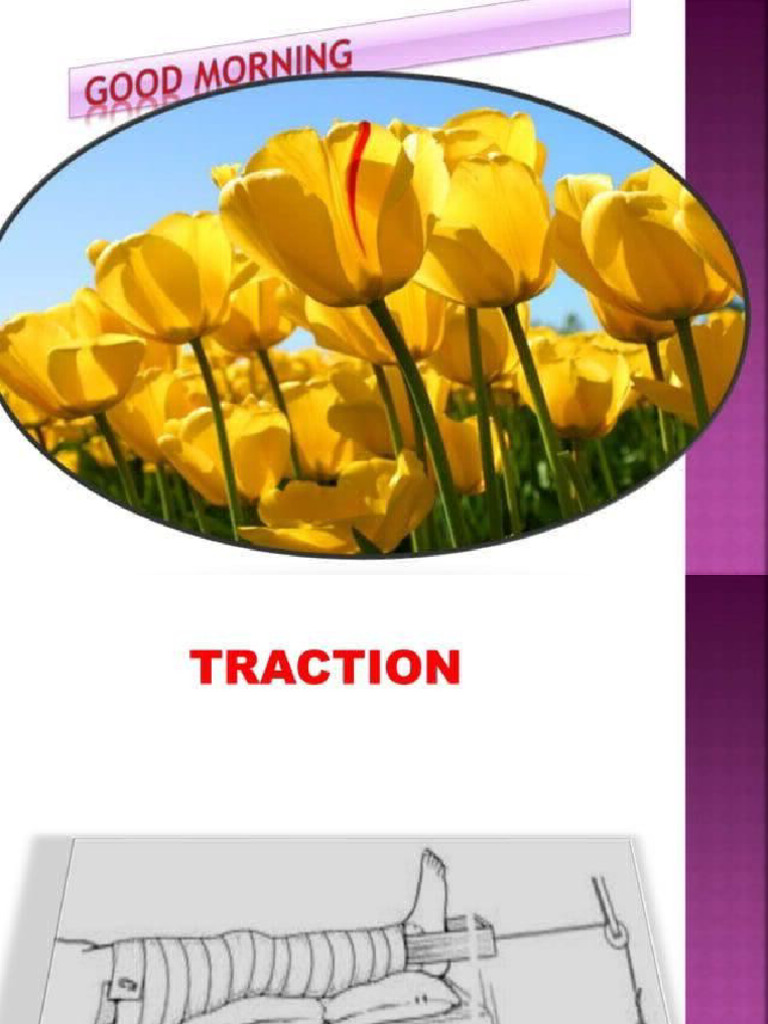 Understanding Traction in Medical Care | PDF