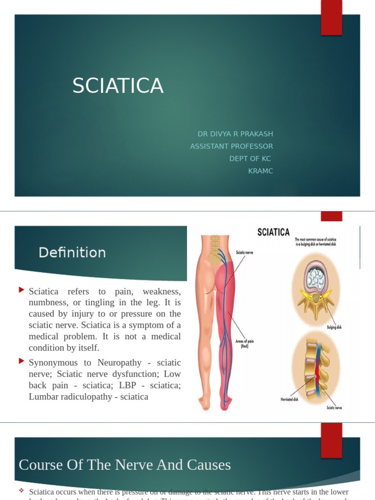 SCIATICA | PDF | Musculoskeletal System | Musculoskeletal Disorders