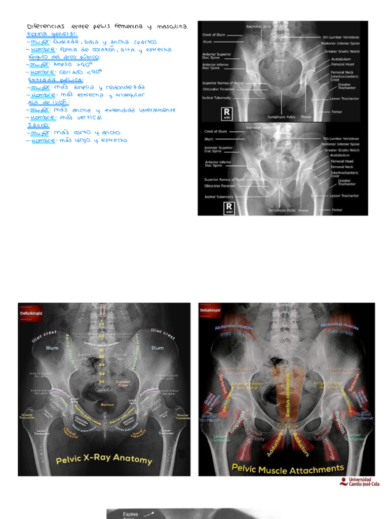 Radiología de La Pelvis | PDF