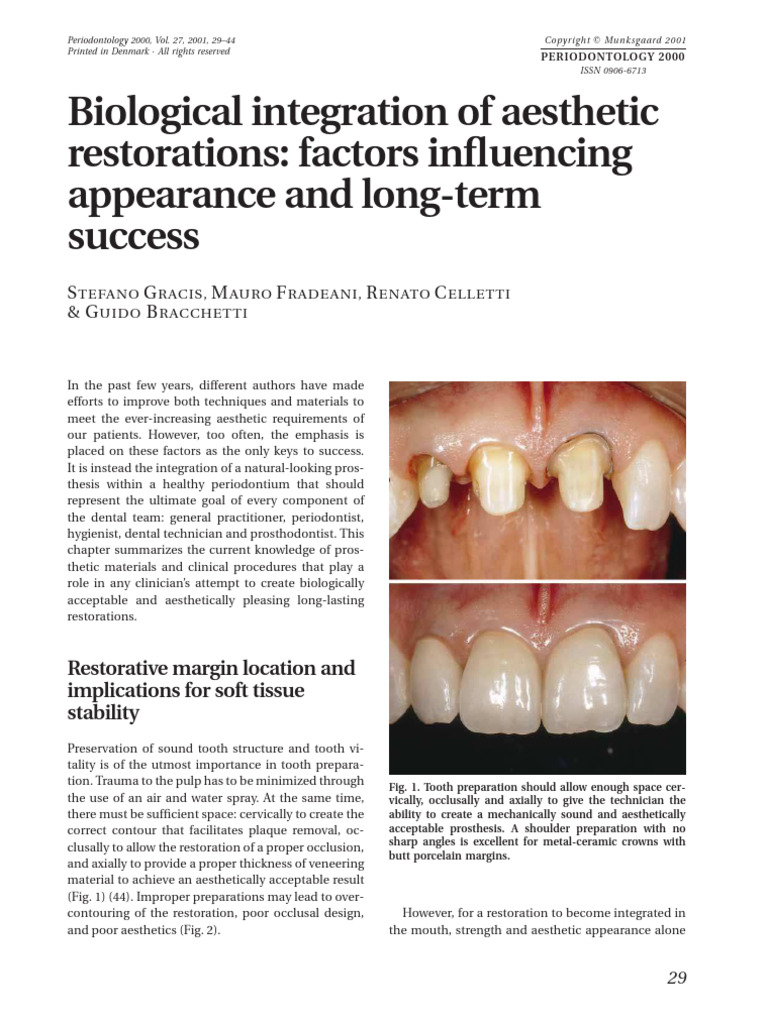 Biological Integration of Aesthetic Rest | PDF | Periodontology ...