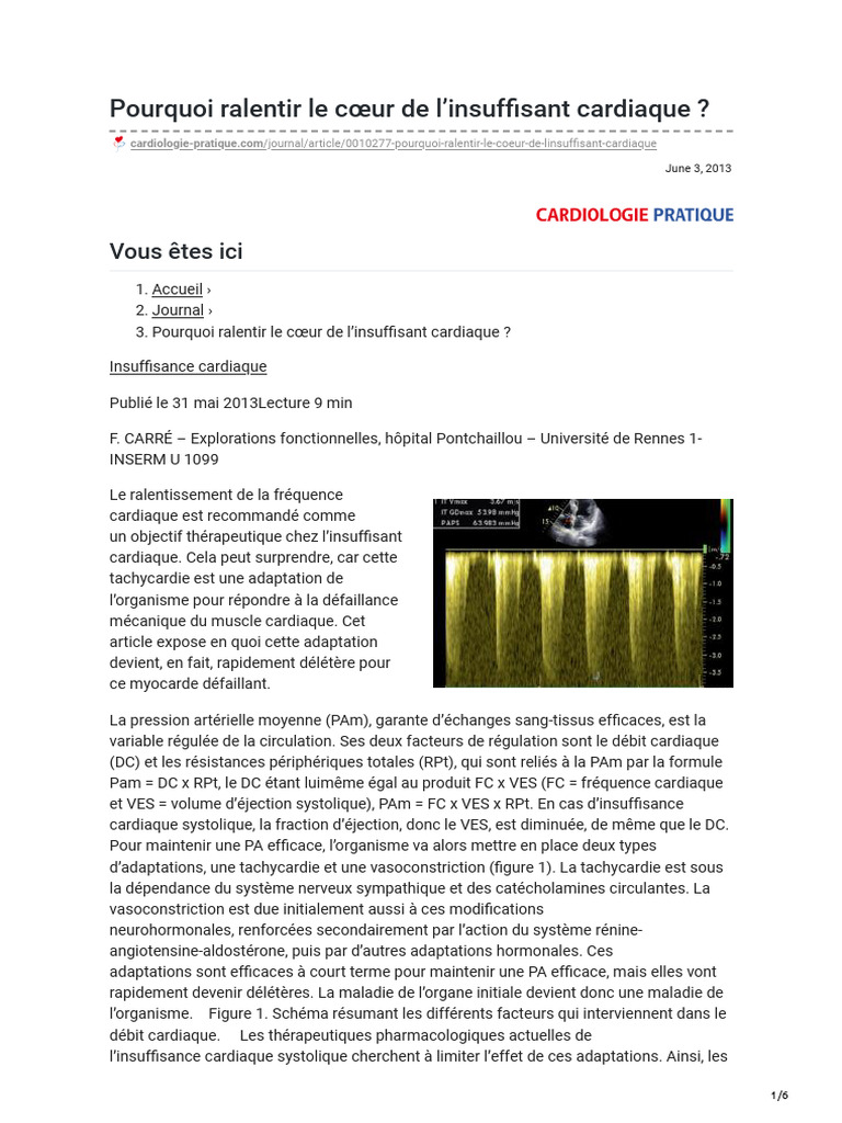 Ralentir le cœur en insuffisance cardiaque | PDF | Insuffisance ...