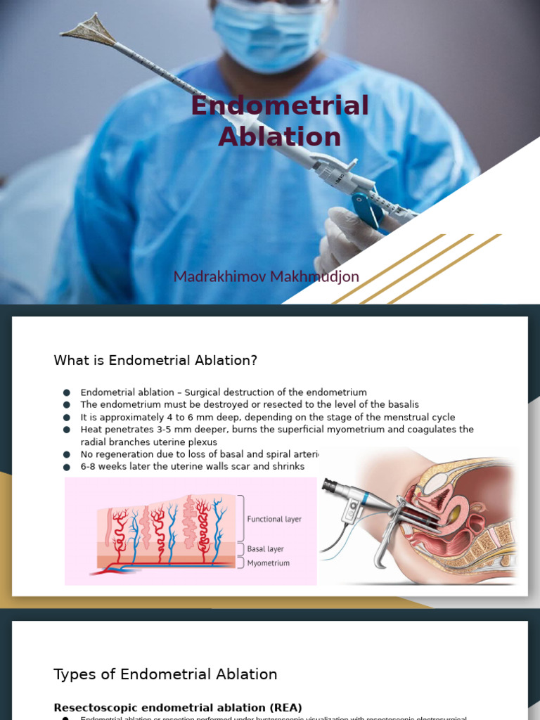 Endometrial Ablation MM | PDF | Medical Specialties | Clinical Medicine