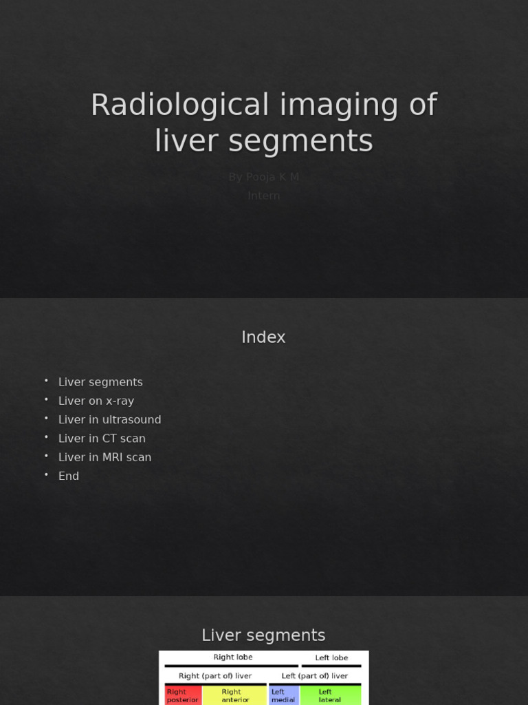 Radiological Imaging of Liver Segments | PDF