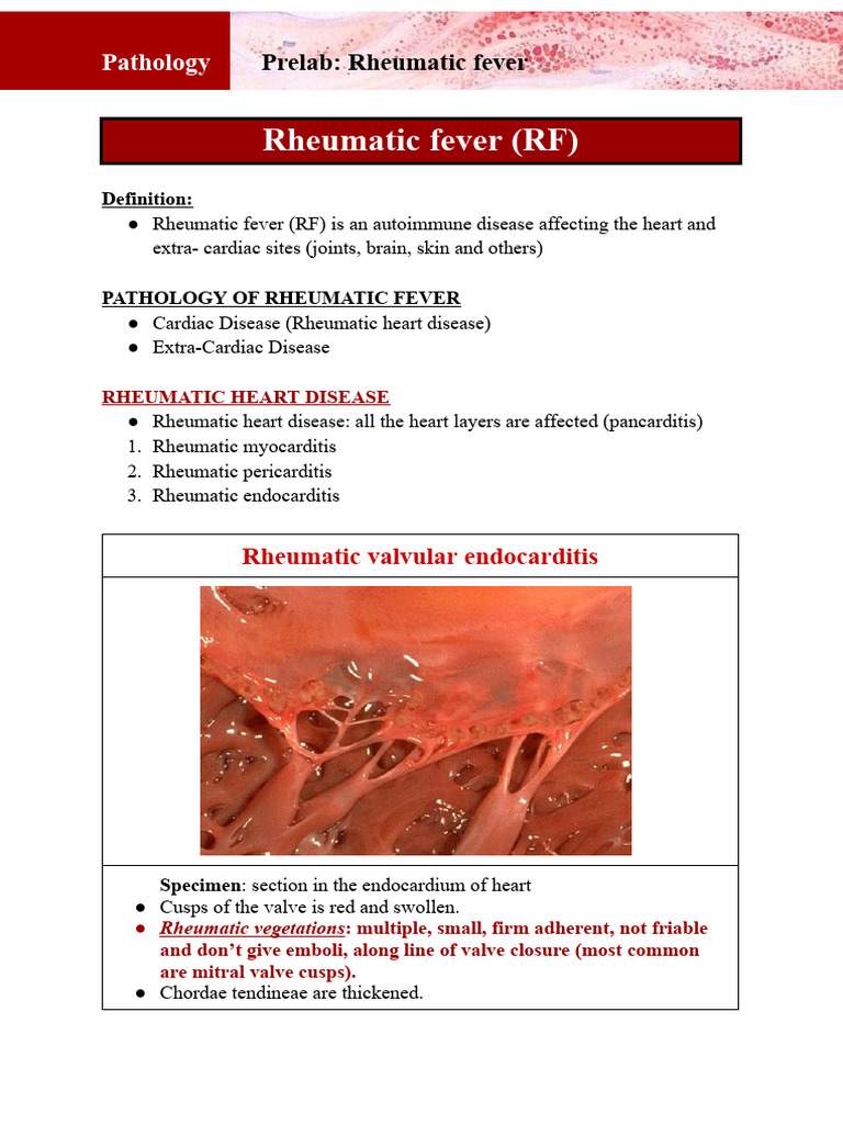 Rheumatic Fever | PDF
