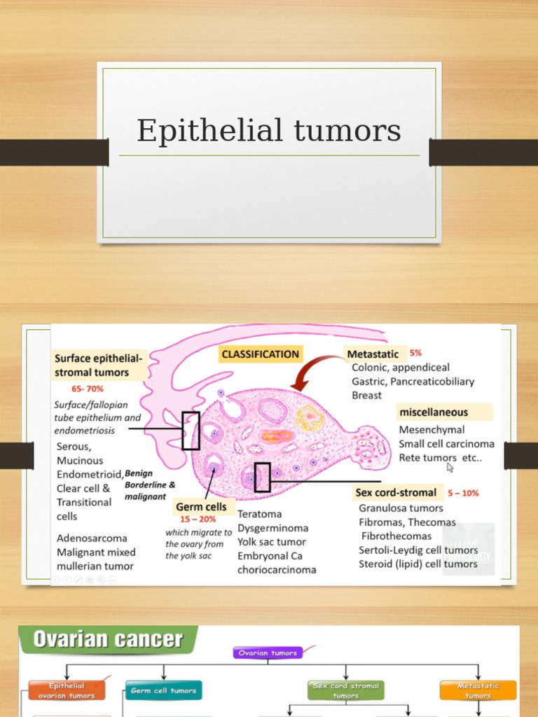 Surface Epithelial Tumors | PDF | Ovarian Cancer | Neoplasms