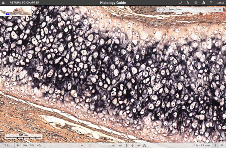Elastic Cartilage Cartilage and Bone | PDF