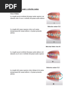 Relación Dental: Clases de Angle y Andrews | PDF | Anatomia dental | Diente