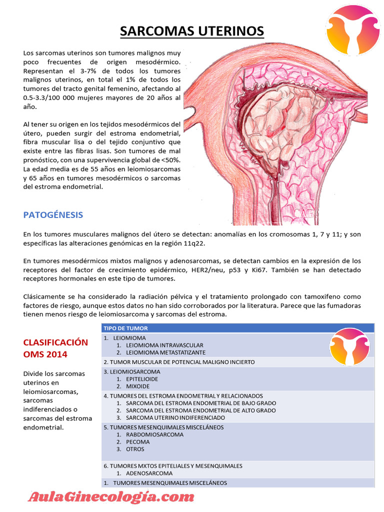 SARCOMAS-UTERINOS (1) | PDF | Sarcoma | Neoplasias