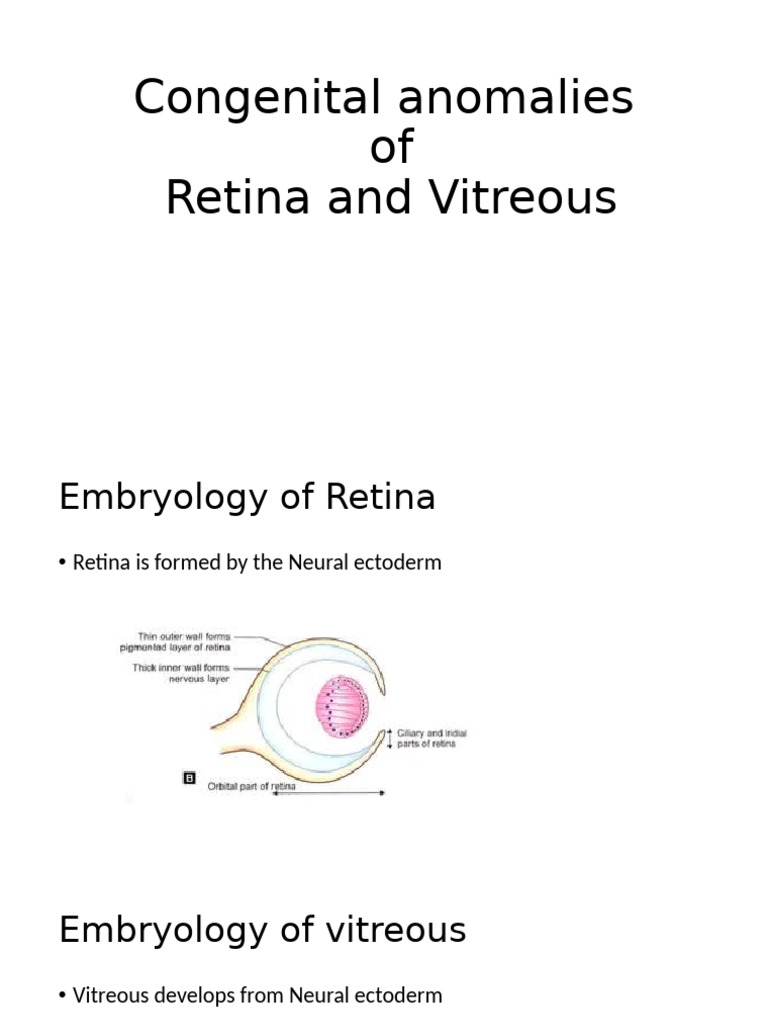 Congenital Retina and Vitreous Anomalies | PDF | Vitamin A | Retina