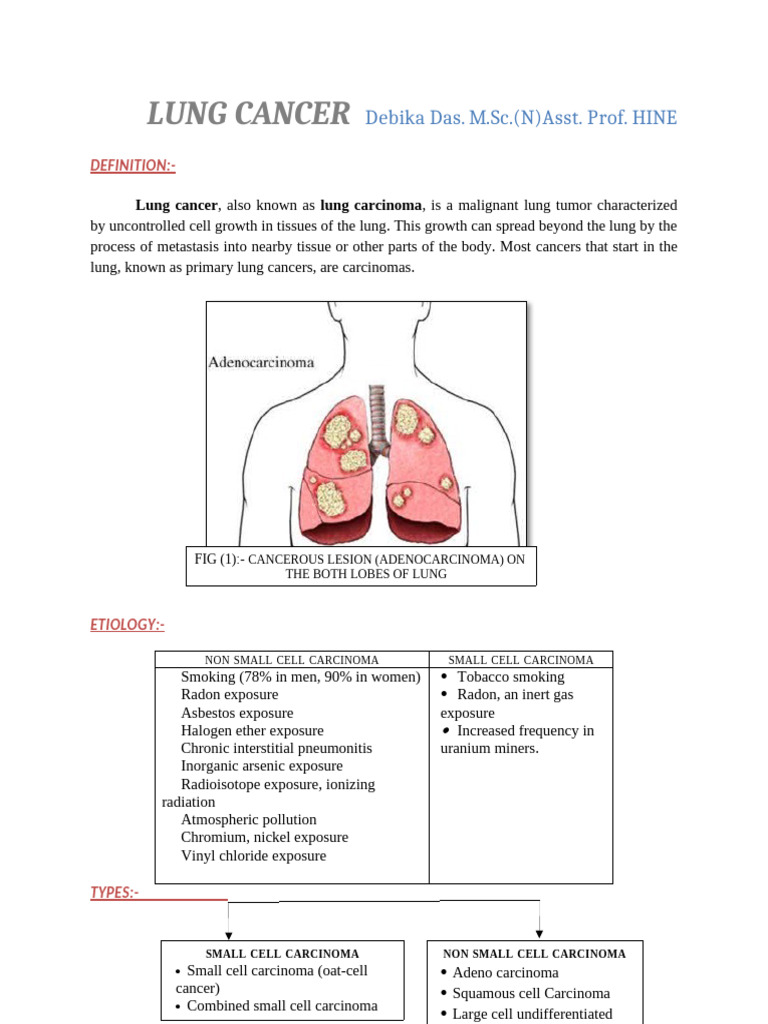 LUNG CANCER, Debika Das, M.SC (N) Neuroscience Nursing | PDF | Lung Cancer | Metastasis