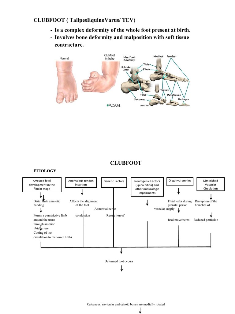 Patho Clubfoot | PDF