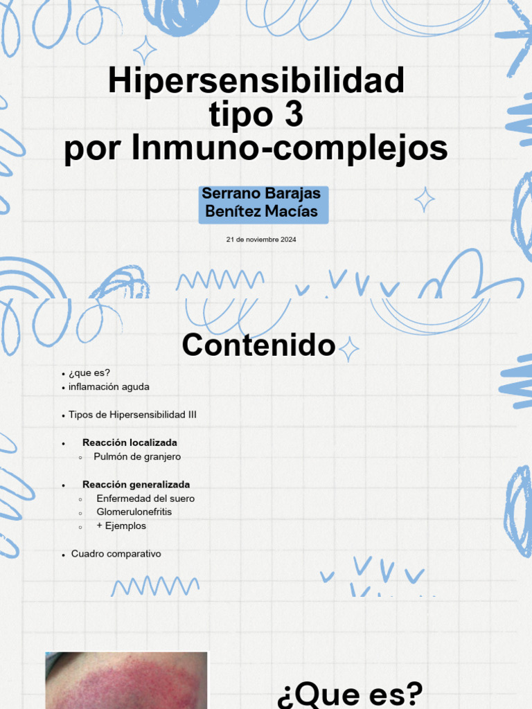 Hipersensibilidad Tipo 3 | PDF | Inflamación | Sistema complementario