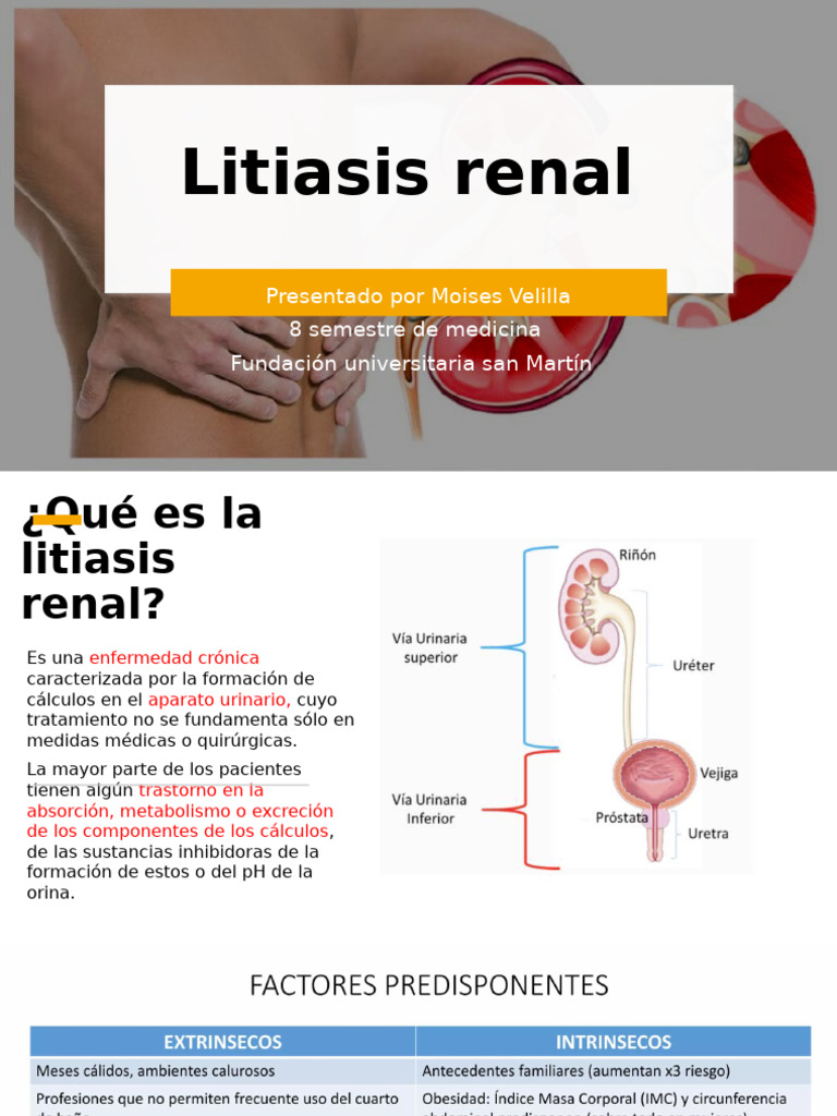 Litiasis Renal | PDF | Calcio
