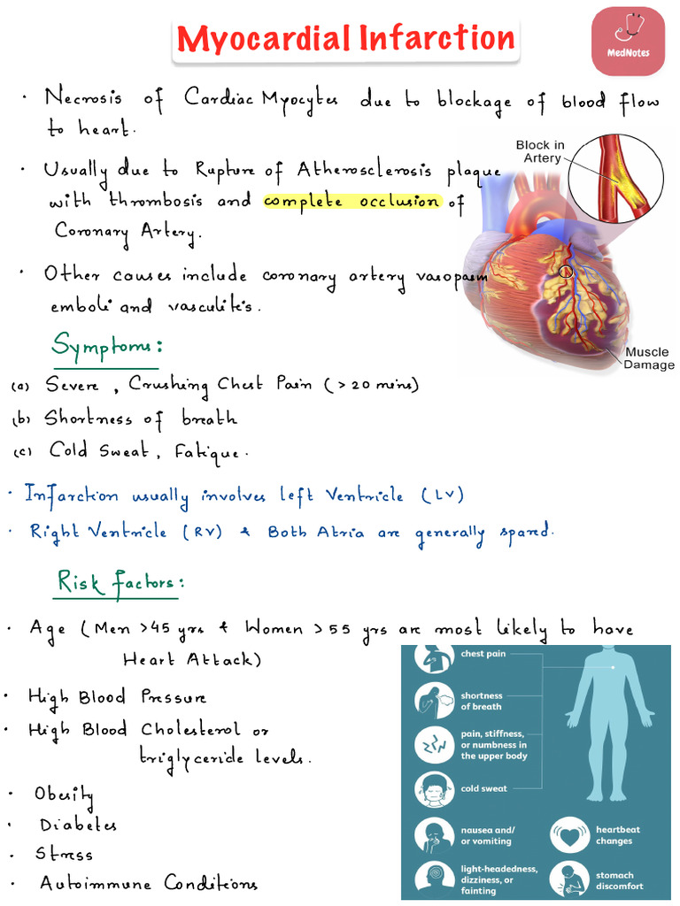 Myocardial Infarction | PDF | Myocardial Infarction | Thorax (Human ...